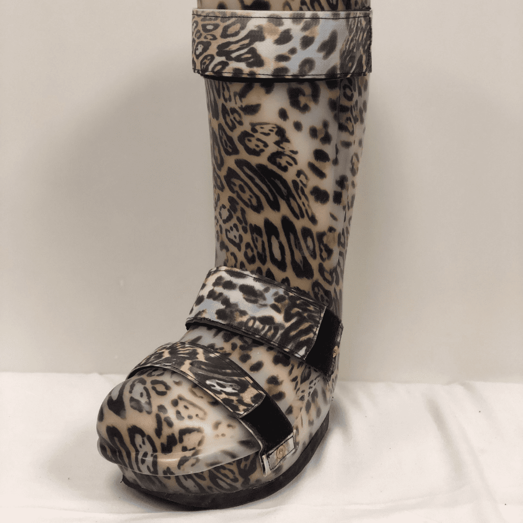 Charcot Arthropathy - Custom Orthotic