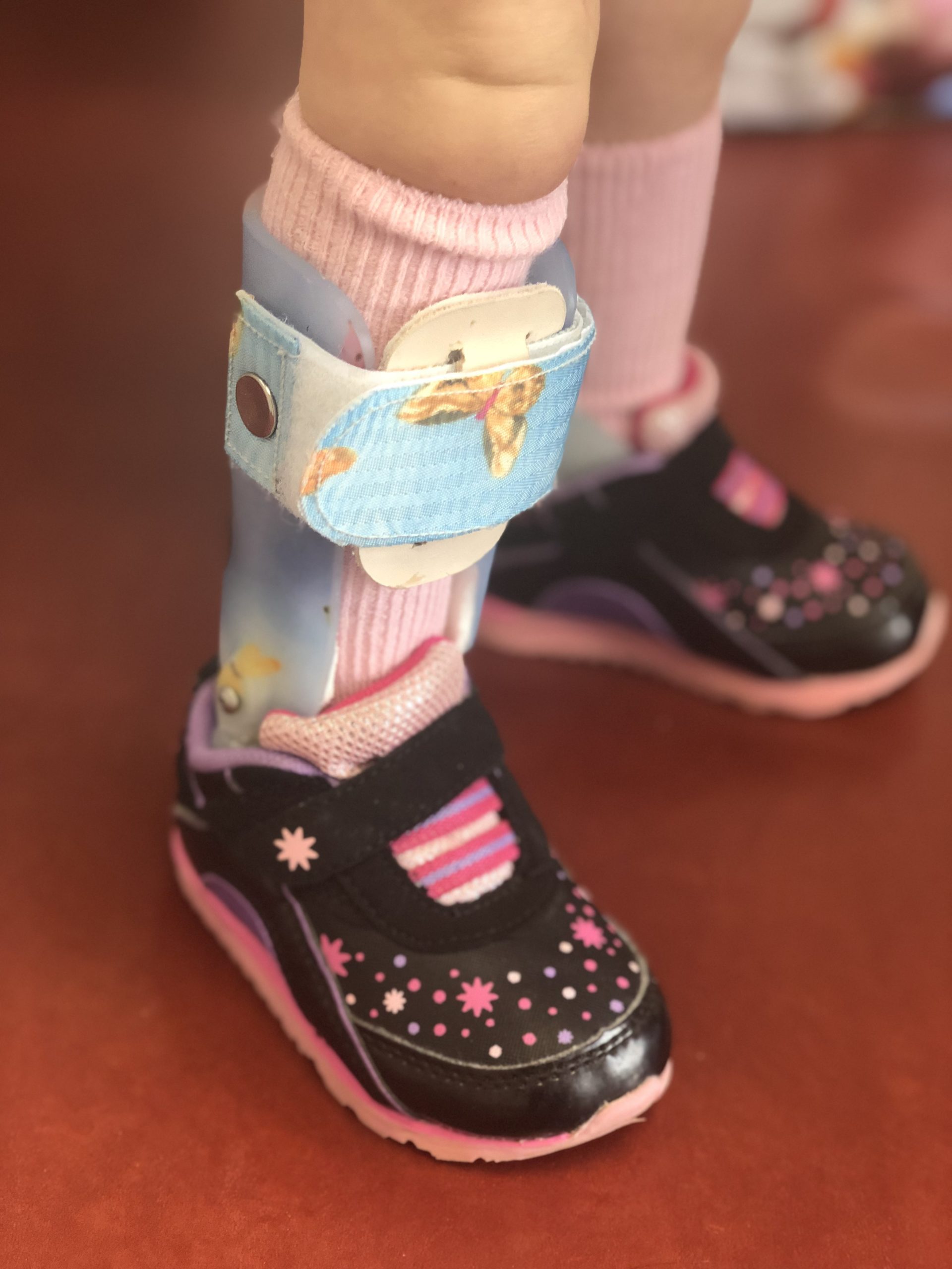Bracing for Kids - Custom Orthotic